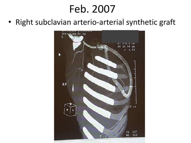difficult vascular access | PPTX