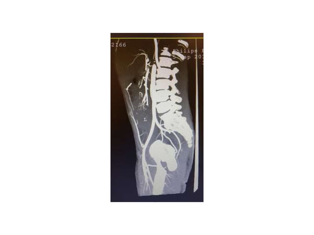 difficult vascular access | PPTX