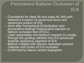 Final jna surgery | PPTX