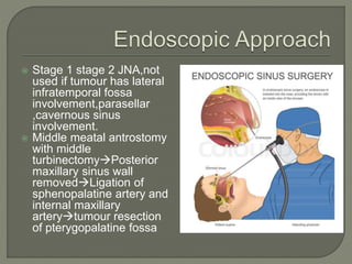 Final jna surgery | PPTX