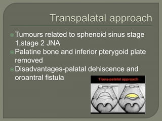 Final jna surgery | PPTX
