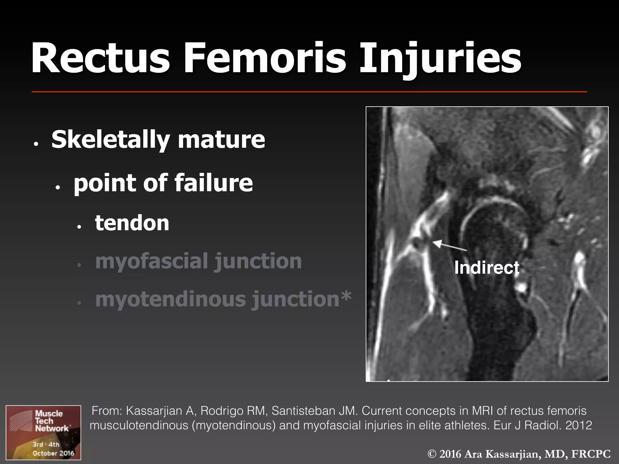 Ara Kassarjian: MRI of the Rectus Femoris - PRP | PPTX