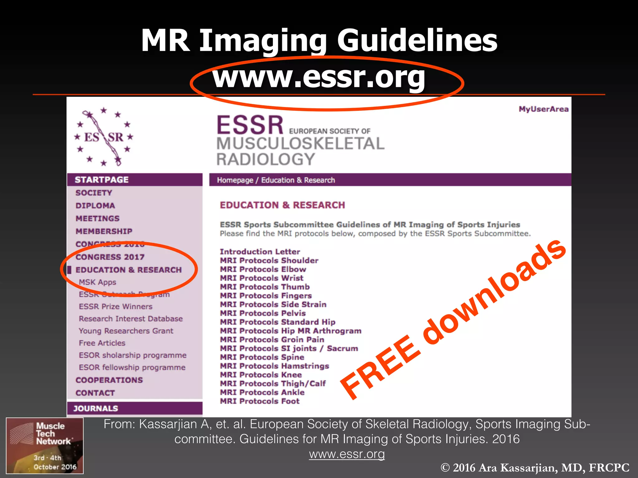 Ara Kassarjian: MRI of the Rectus Femoris - PRP | PPTX