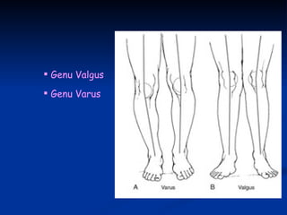 Knee complex | PPT