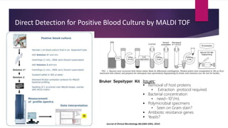 MALDI - TOF MS: Where Mass Spectrometry Meets Microbiology | PPTX