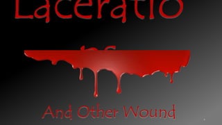 Types of Wounds and Injuries Guide | PPT