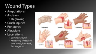 Lacerations | PPT