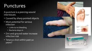 Different Types Of Lacerations