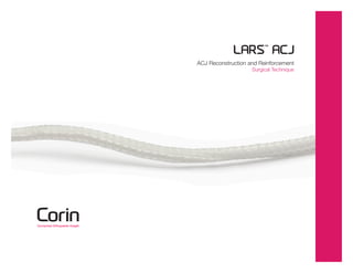 LARS ACJ Surgical Technique Corin Lennard Funk | PDF