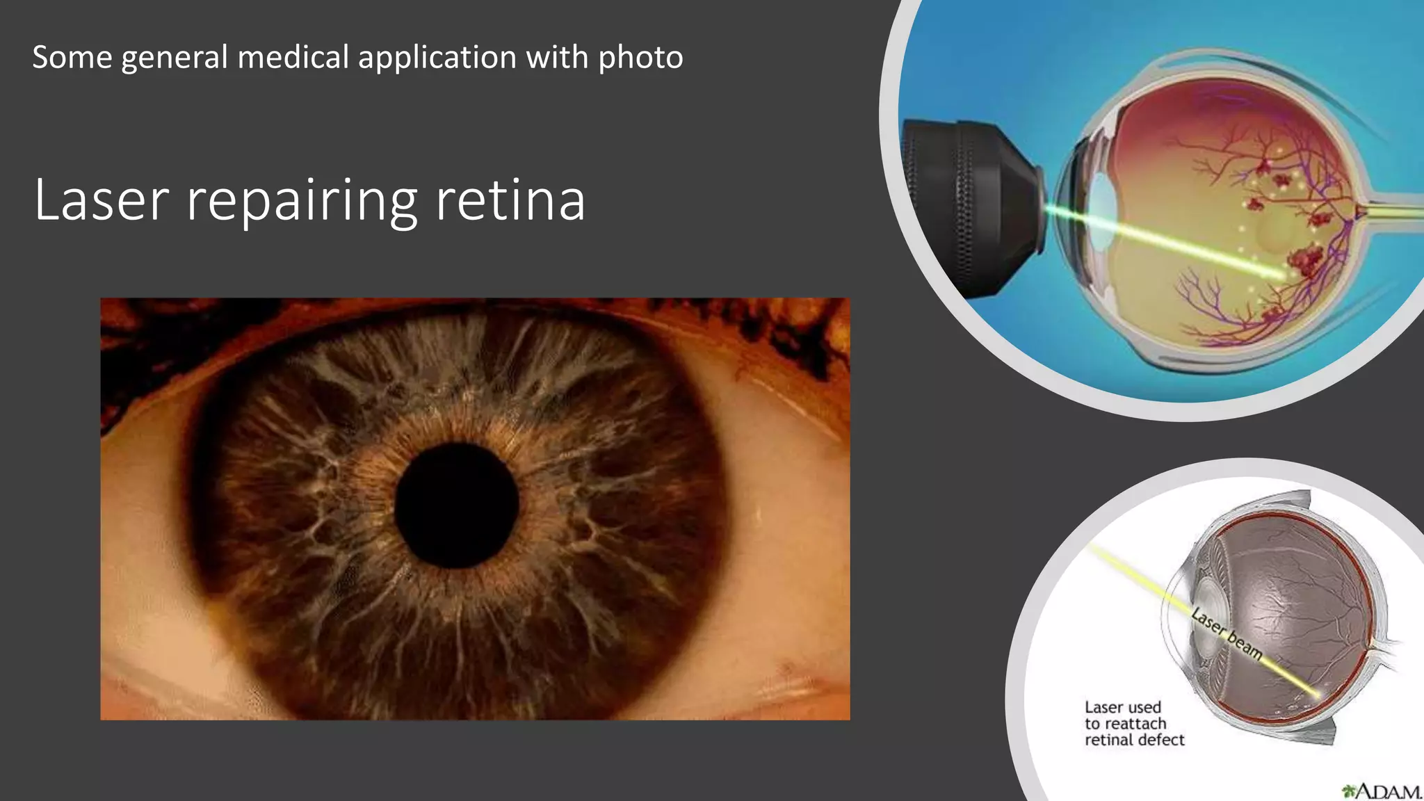 medical application of laser | PPTX