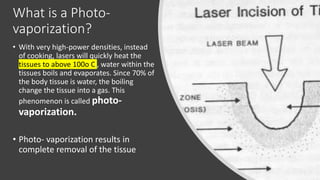 medical application of laser | PPTX
