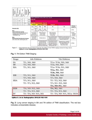 Restaging of Bronchogenic Carcinoma Based on 7th Edition of TNM ...