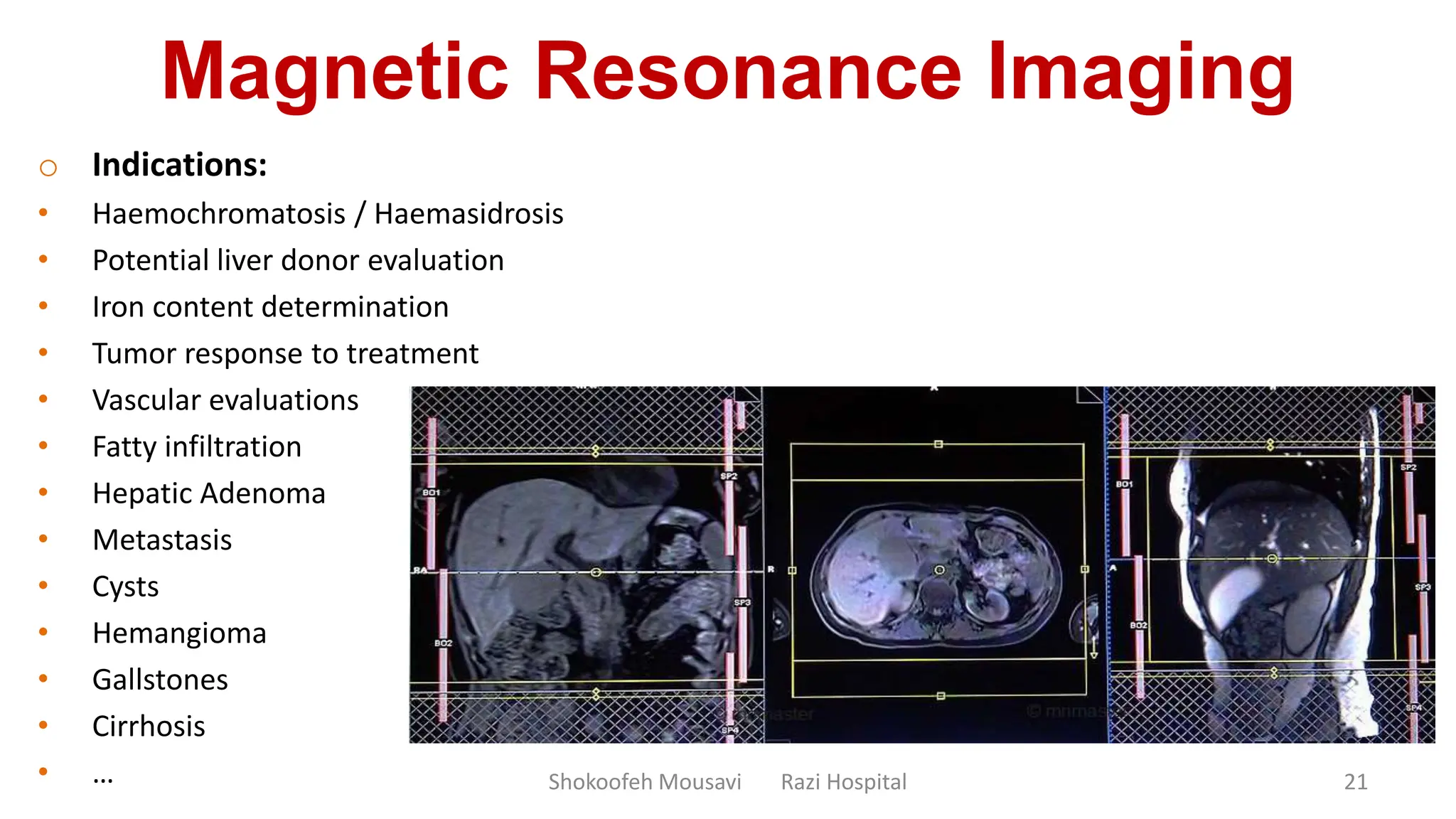 Liver Imaging | PPSX
