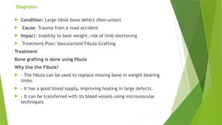 Fibula Bone Anatomy And It's Ayurvedic Aspects | PPTX
