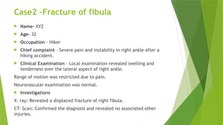 Fibula Bone Anatomy And It's Ayurvedic Aspects | PPTX