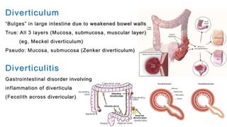 Acute Diverticulitis.pptx | Digestive Disorders | Diseases and Conditions