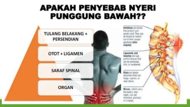 Materi Penyuluhan - Back Pain.pptx