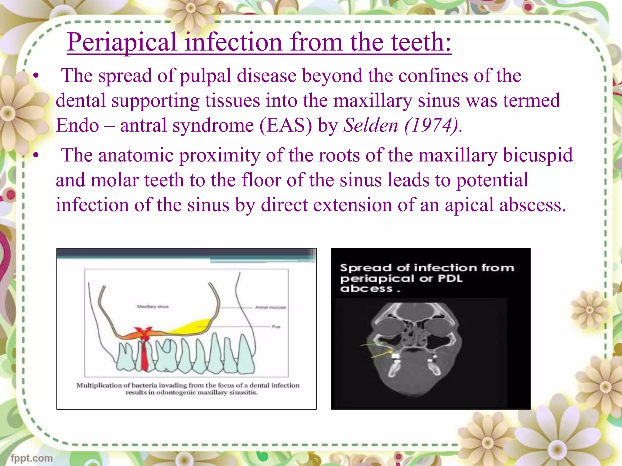maxillary sinus seminar | PPTX