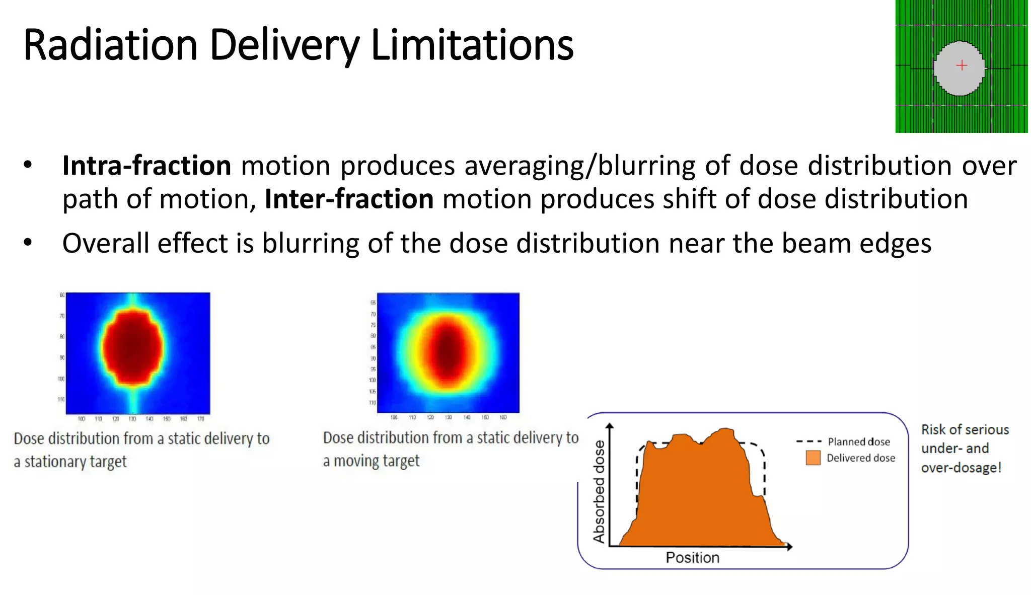 Motion Management in Radiation Therapy | PDF