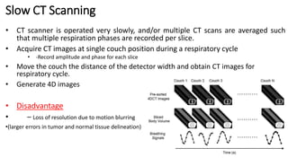 Motion Management in Radiation Therapy | PDF