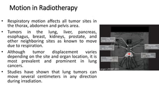 Motion Management in Radiation Therapy | PDF