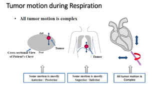 Motion Management in Radiation Therapy | PDF
