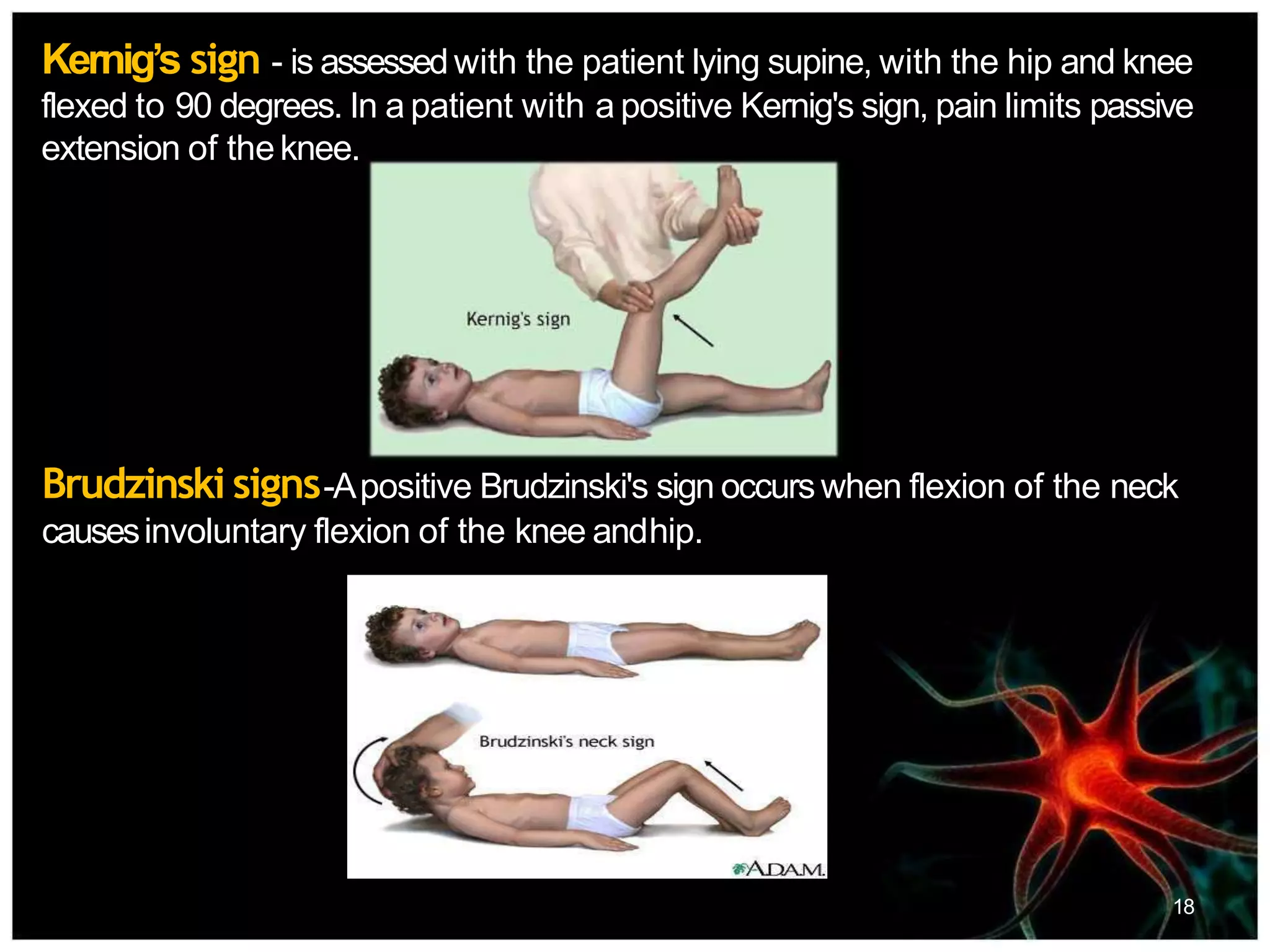 FINAL MENINGITIS.pptx