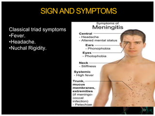 FINAL MENINGITIS.pptx