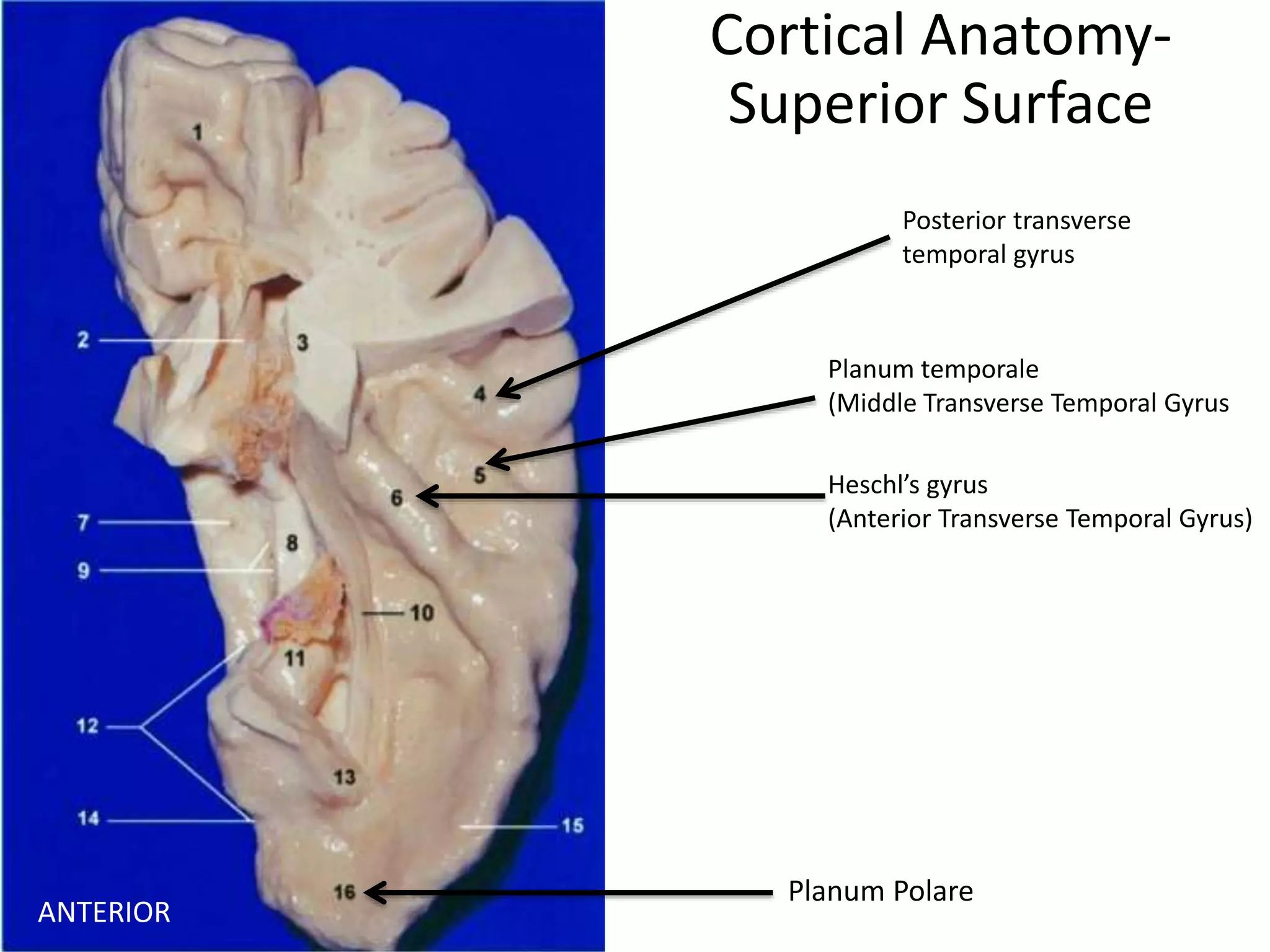 Final microsurgical anatomy of medial temporal lobe | PPTX