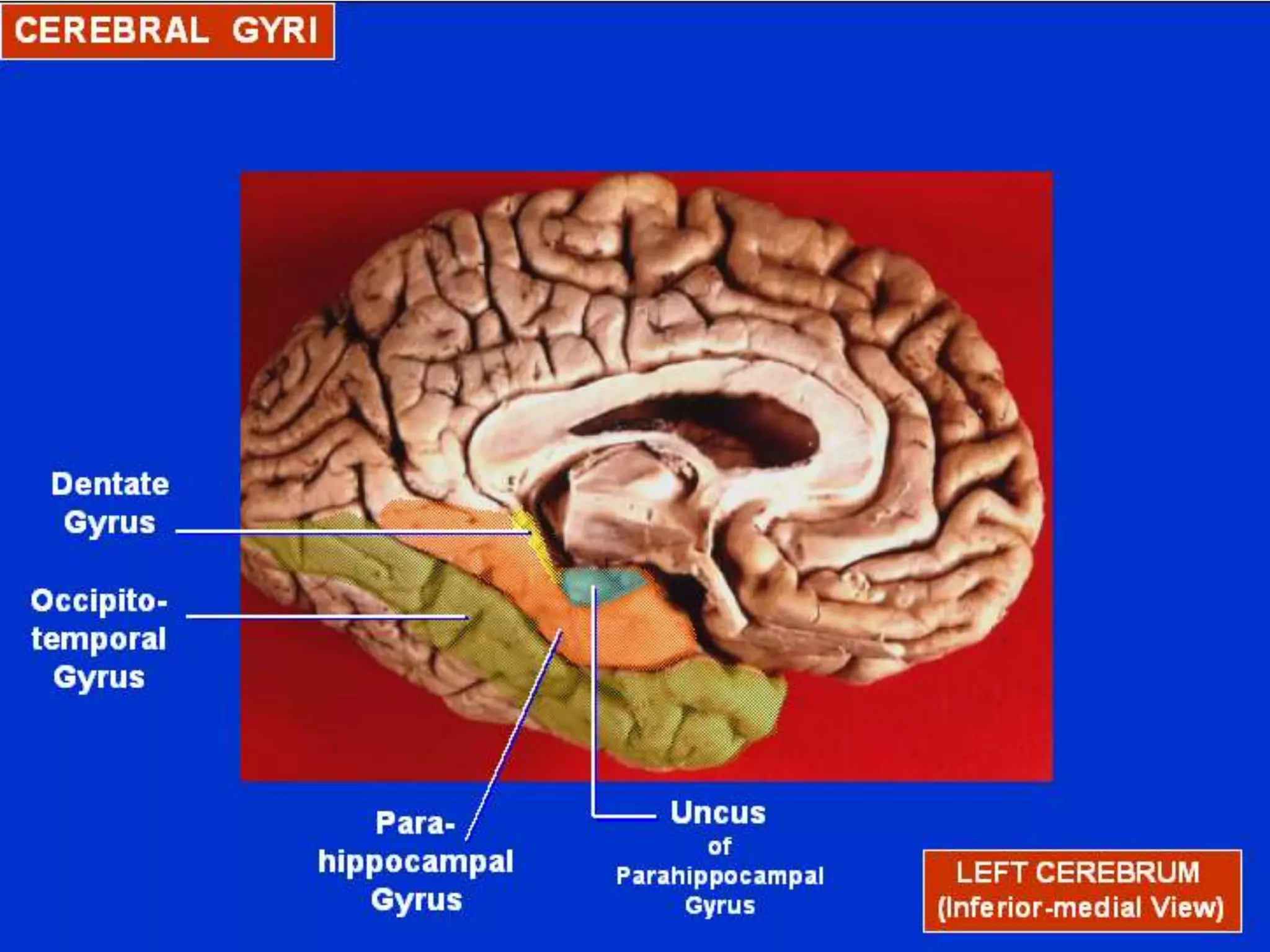Final microsurgical anatomy of medial temporal lobe | PPTX