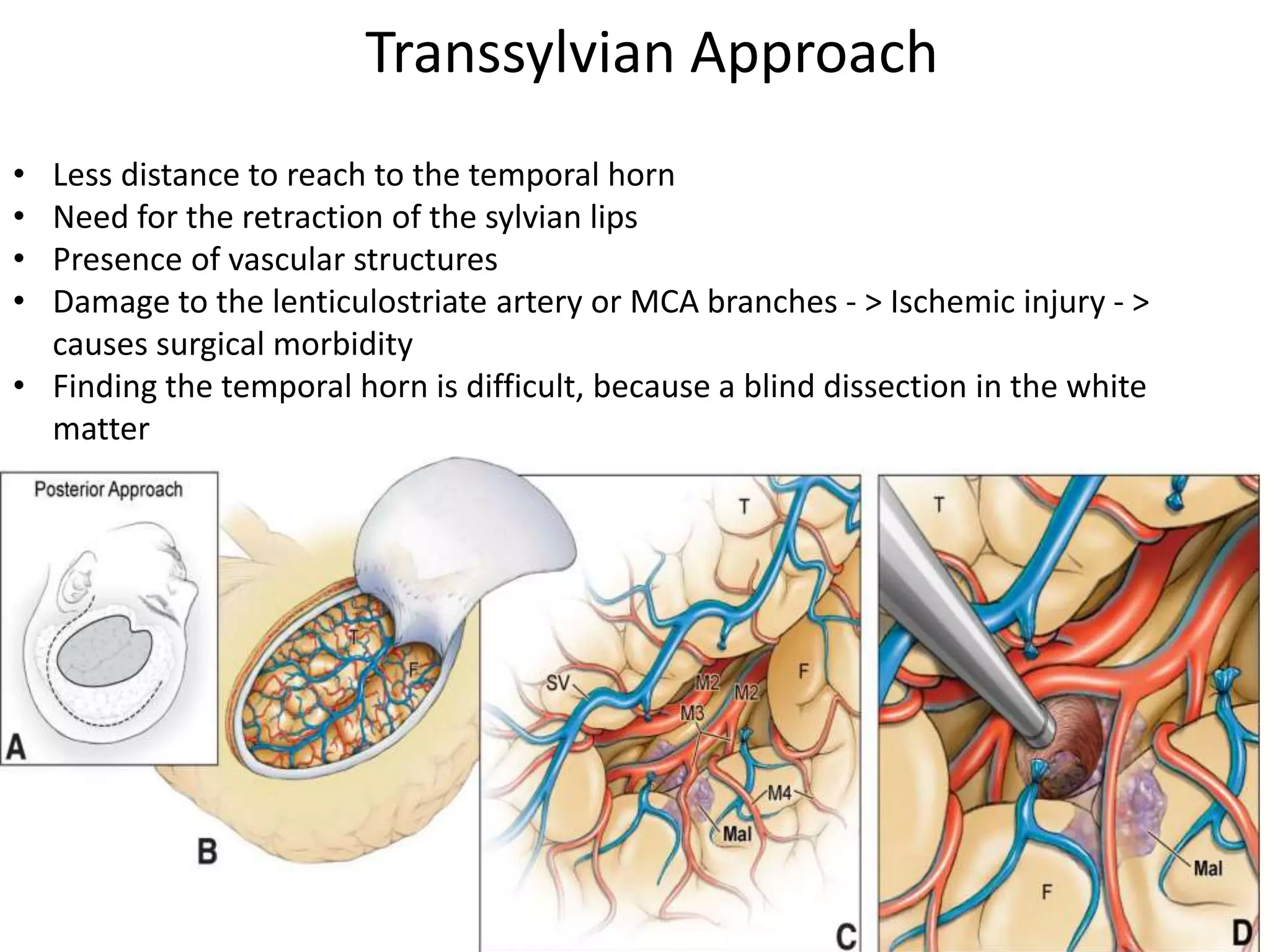Final microsurgical anatomy of medial temporal lobe | PPTX