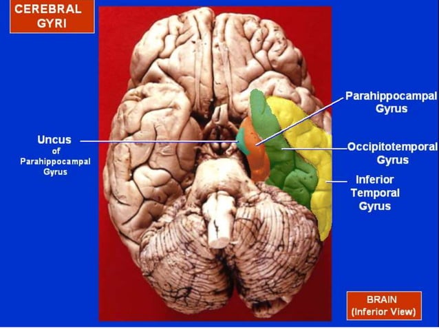 Final microsurgical anatomy of medial temporal lobe | PPTX | Brain and ...