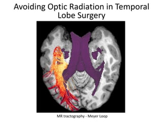 Final microsurgical anatomy of medial temporal lobe | PPTX