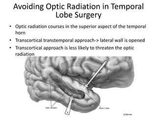 Final microsurgical anatomy of medial temporal lobe | PPTX