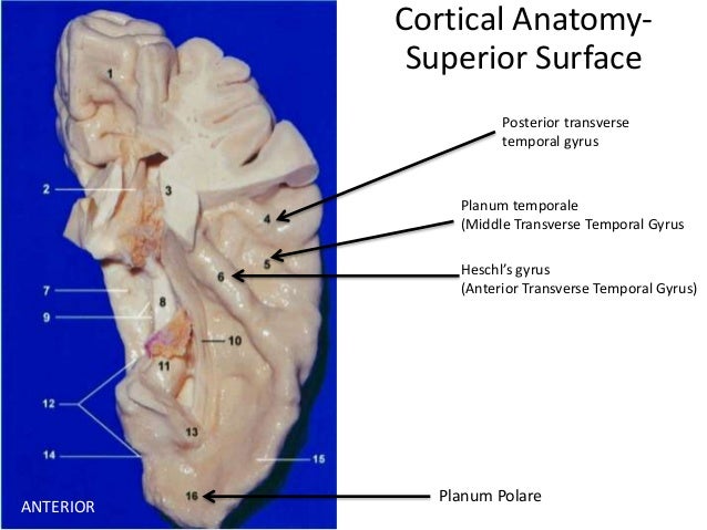 Final microsurgical anatomy of medial temporal lobe