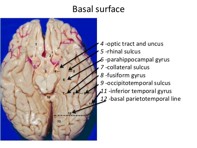 Medial Temporal Lobe Anatomy Medial Temporal Lobe Anatomy