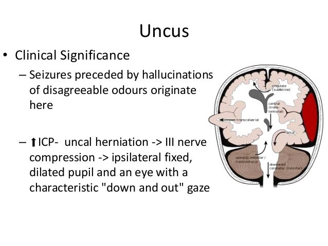 Final microsurgical anatomy of medial temporal lobe