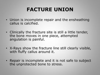Bone union and advances | PPTX