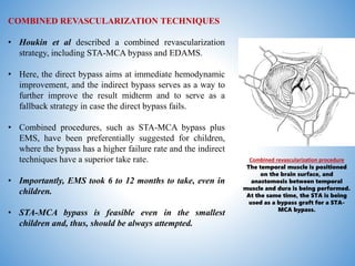 classification, pathophysiology and surgical management MOYAMOYA.pptx
