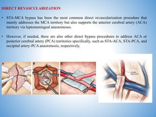 classification, pathophysiology and surgical management MOYAMOYA.pptx
