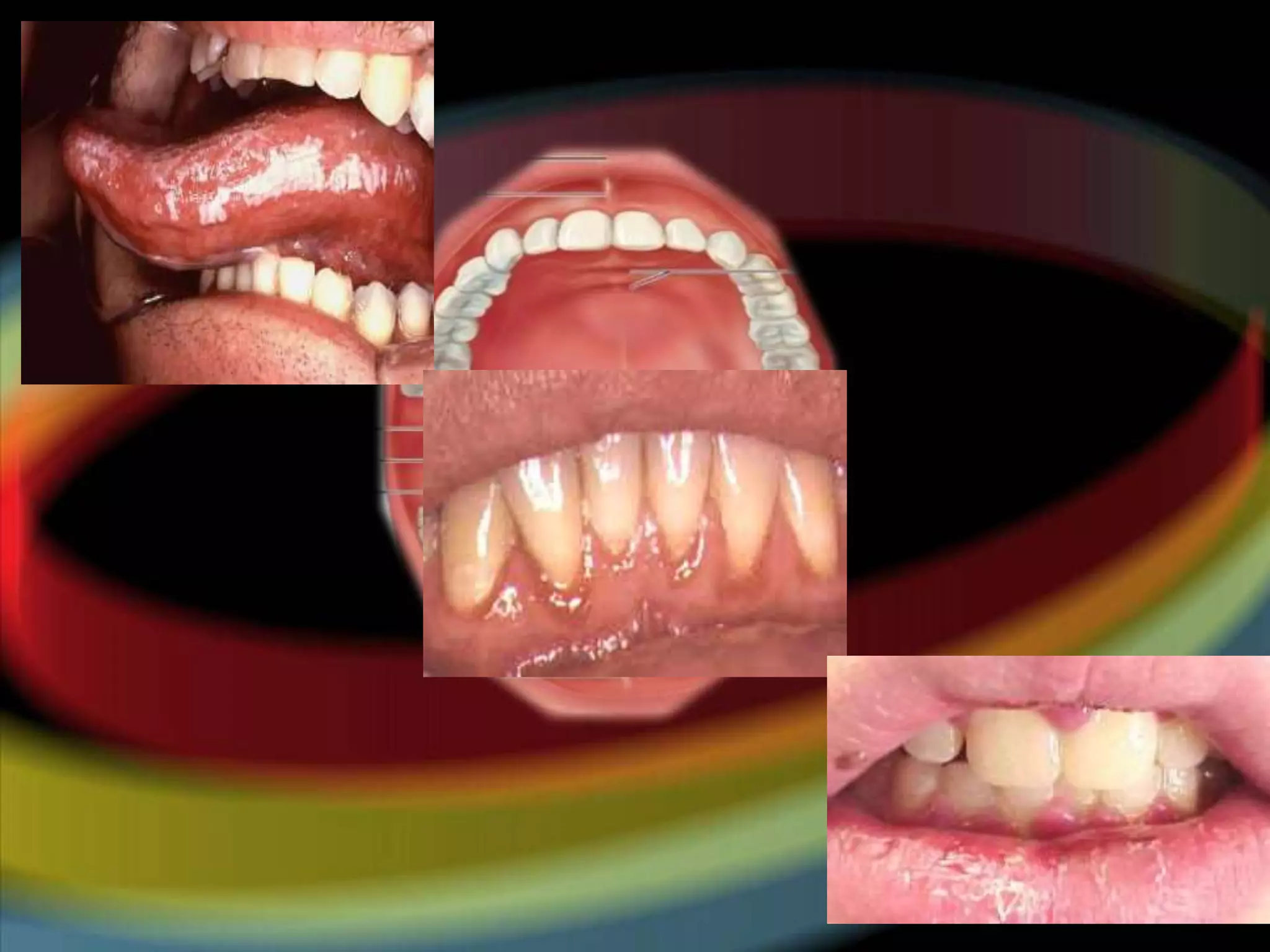 Final mucosa ppt 2007 | PPTX