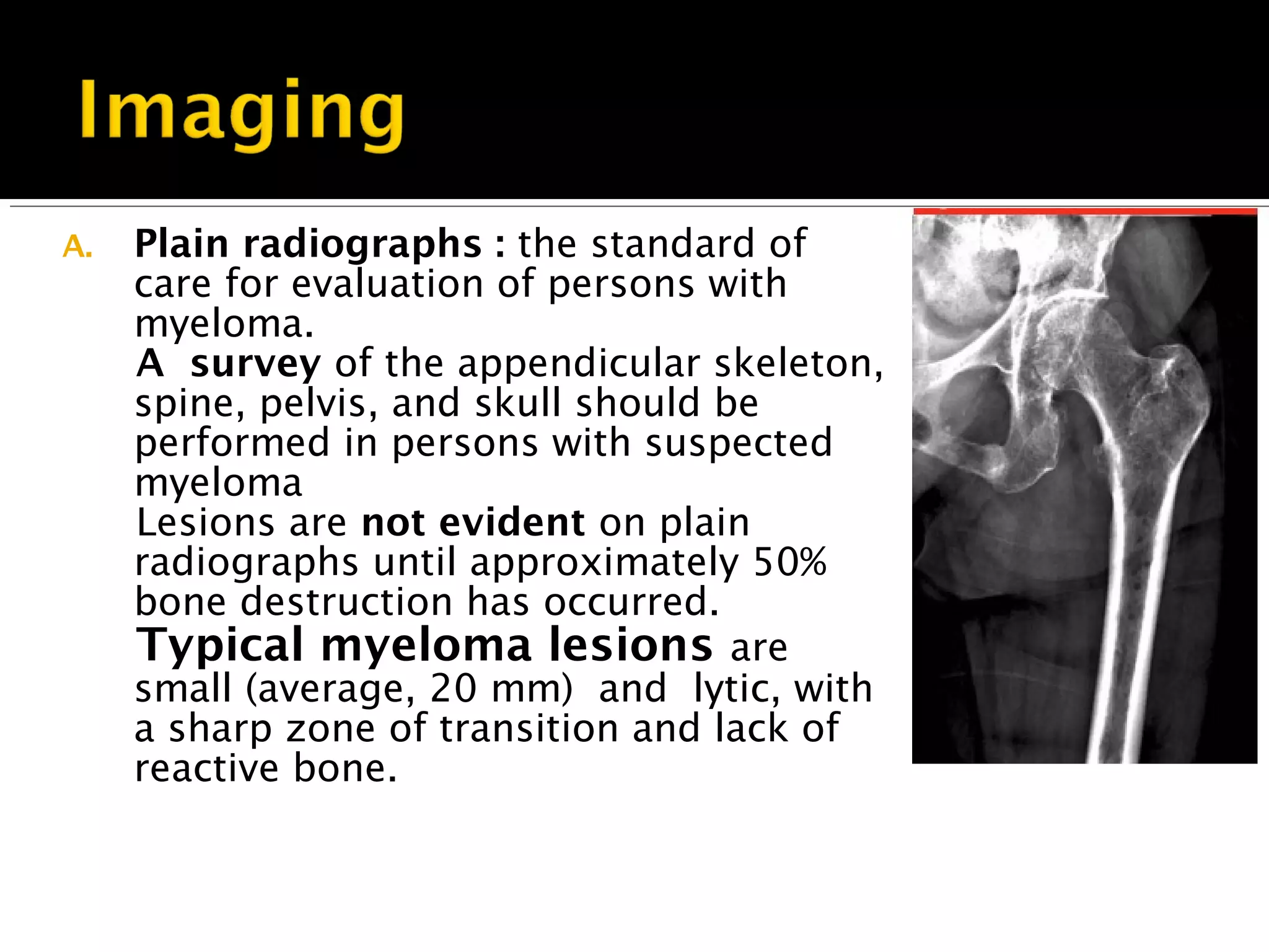 Final multiple myeloma | PPT