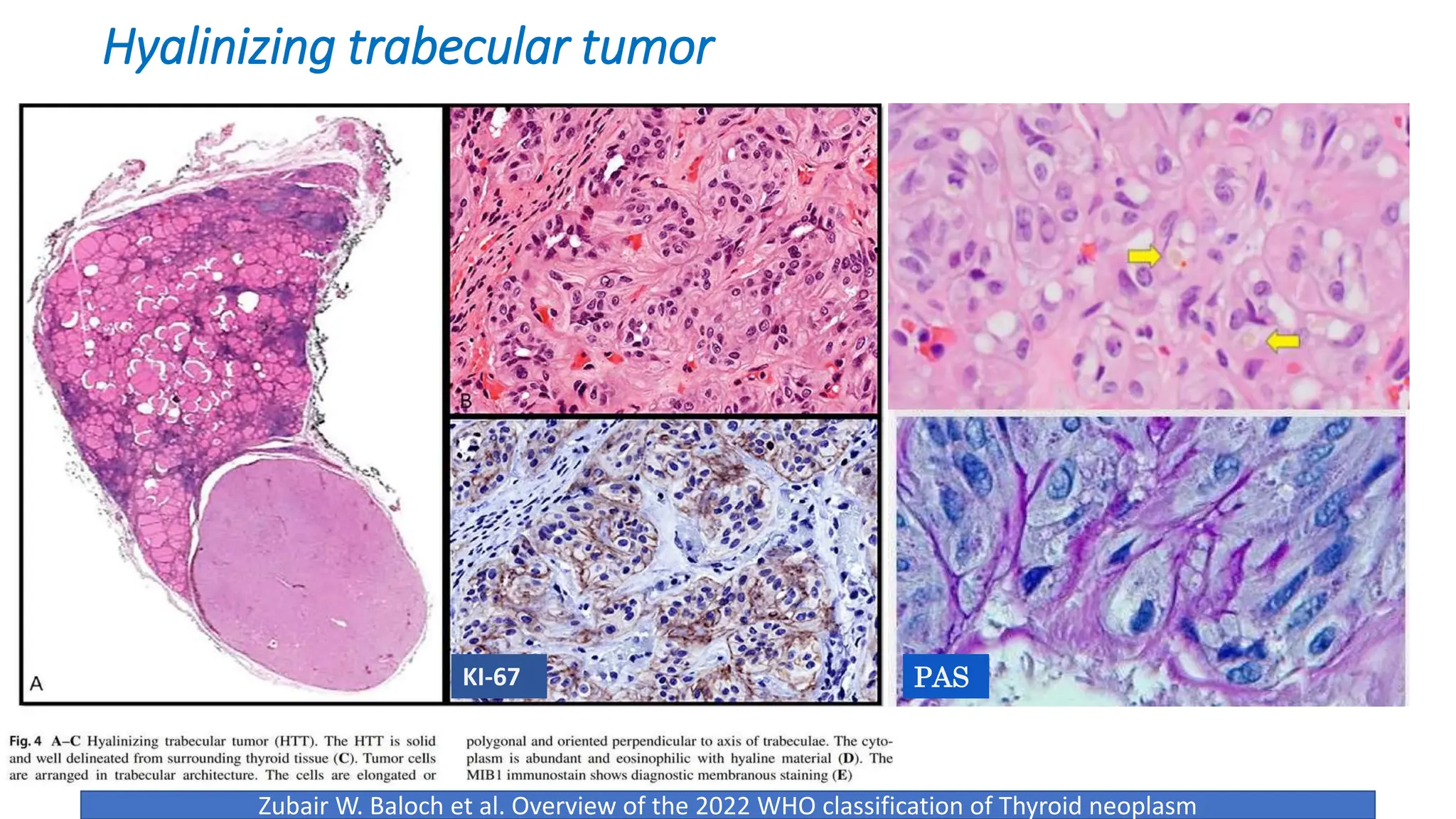 FINAL New WHO thyroid update.pptx