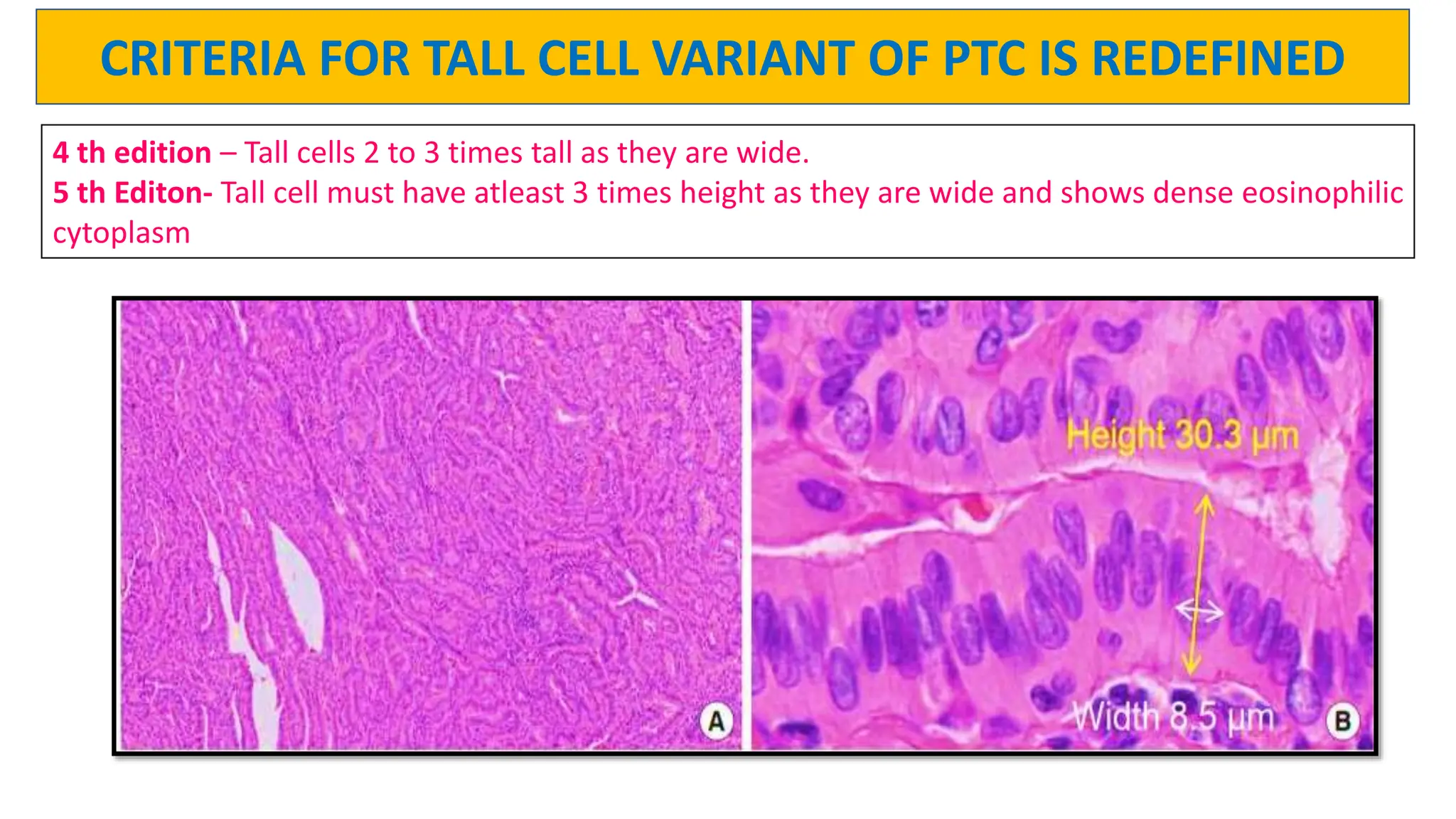 FINAL New WHO thyroid update.pptx
