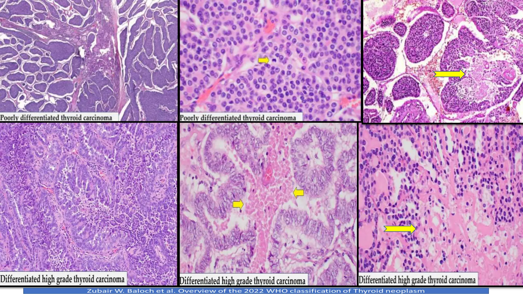 FINAL New WHO thyroid update.pptx