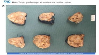 FINAL New WHO thyroid update.pptx