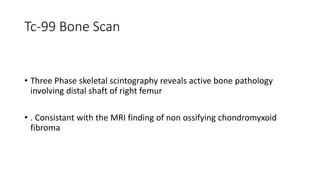 FINAL NON OSSIFYIG FIBROMA -.pptx