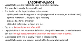 Ocular Manifestations of Leprosy - EYE | PPTX