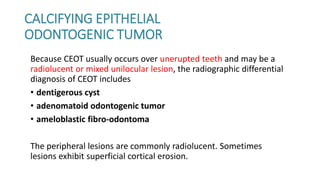 Odontogenic Tumors Oral Pathology | PPTX