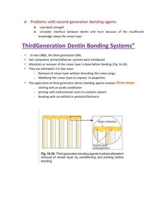 Bonding to Enamel and Dentin Bonding to Enamel and Dentin | DOCX